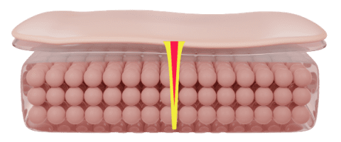Finexel All-in-One CO2 Laser | Skin PIH Treatment - SNJ